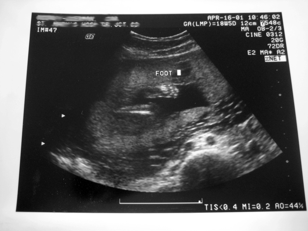 True or False: The timing of conception often determines the gender of ...